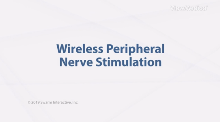 Minimally Invasive Posterior SI Joint Fusion in Onondaga County, NY